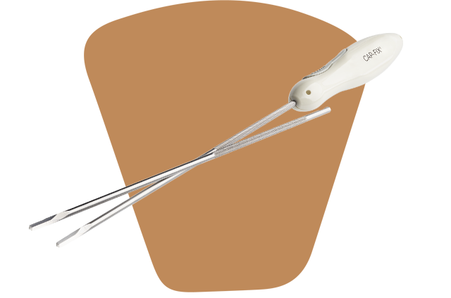 CAP-FIX Capsular Management | Smith+Nephew New Zealand