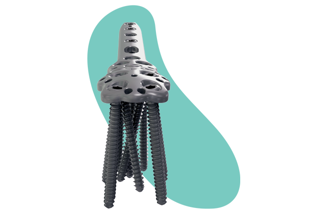 EVOS SMALL Plating System | Smith+Nephew Australia