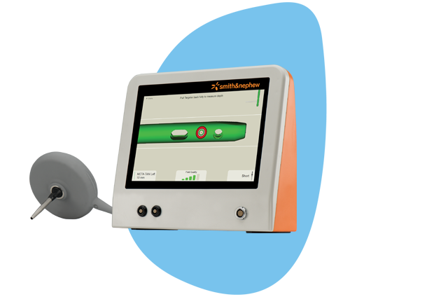 TRIGEN SURESHOT Distal Targeting System