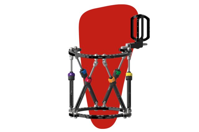 TAYLOR SPATIAL FRAME External Fixator | Smith+Nephew Australia