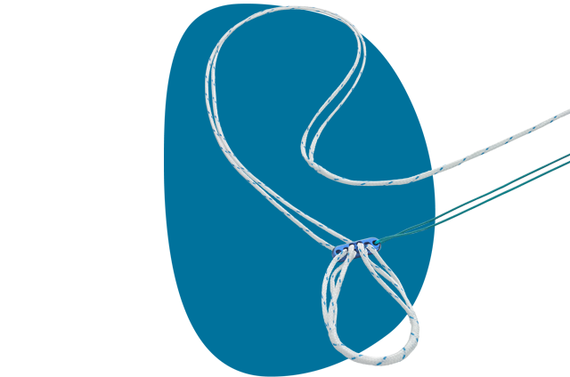 ULTRABUTTON Adjustable Fixation Device Family | Smith+Nephew Global